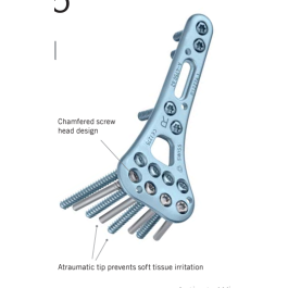 Aptus 2.5 Trilock Express Screw 20mmhd7 Pack of 1 | AHP Ortho